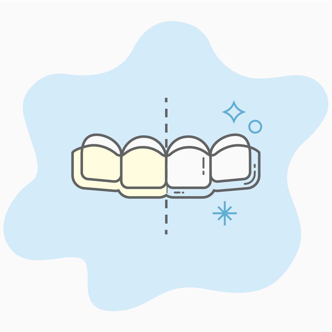 AlignerFresh Original Clean | Aligner and Retainer Cleaner for ...